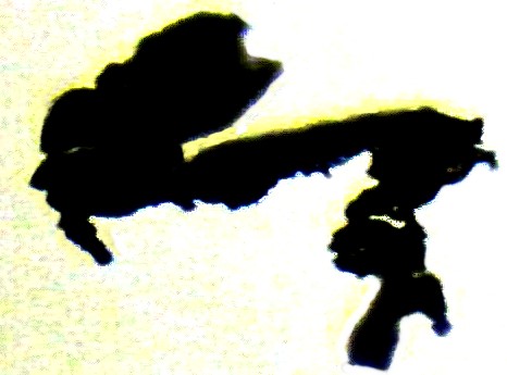 Die Demenz-Erkrankung Morbus Pick ist ansteckend! – WILHELM JOSEF GIEBEL