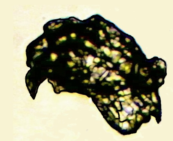 Die Demenz-Erkrankung Morbus Pick ist ansteckend! – WILHELM JOSEF GIEBEL