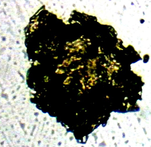 Die Demenz-Erkrankung Morbus Pick ist ansteckend! – WILHELM JOSEF GIEBEL